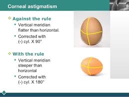 ASTIGMATISM - New