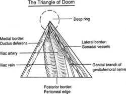 triangle of doom - New