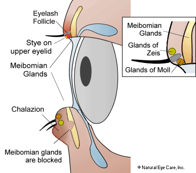 meibomian - New