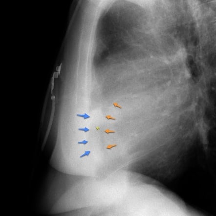 oreo Cookie sign - New