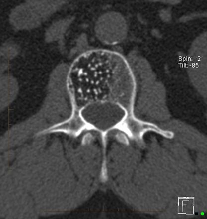 Polka dot sign - New