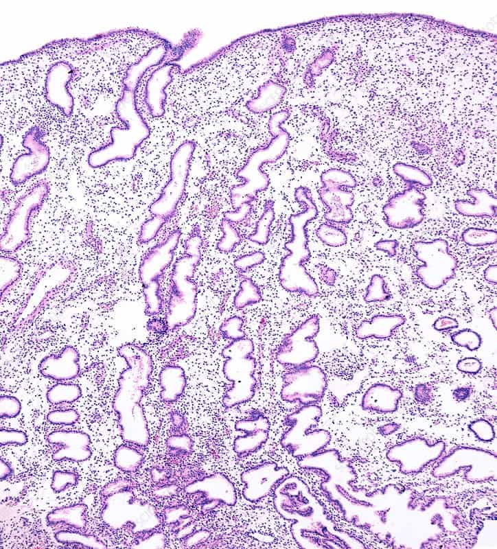Endometrium in secretory phase, light micrograph - New