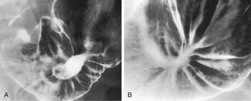 MCQ - 89161 - www.medicoapps.org