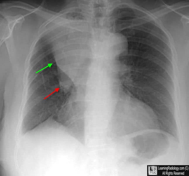 s sign of golden-pa-arr - New