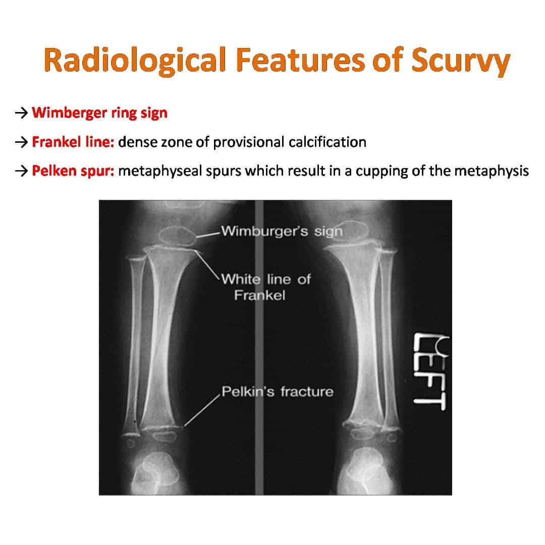 20220429020407 - New