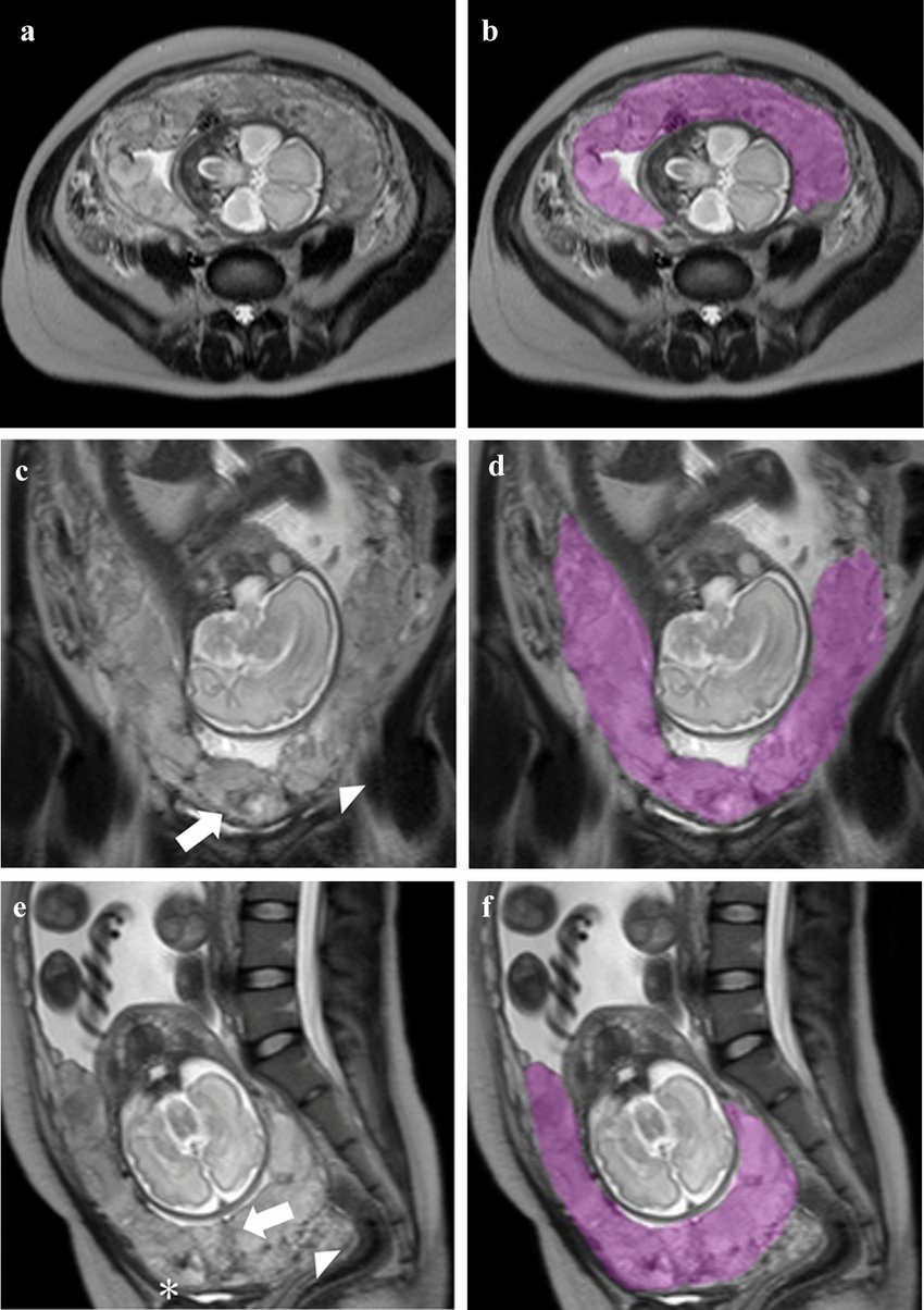 20241025021006 - New